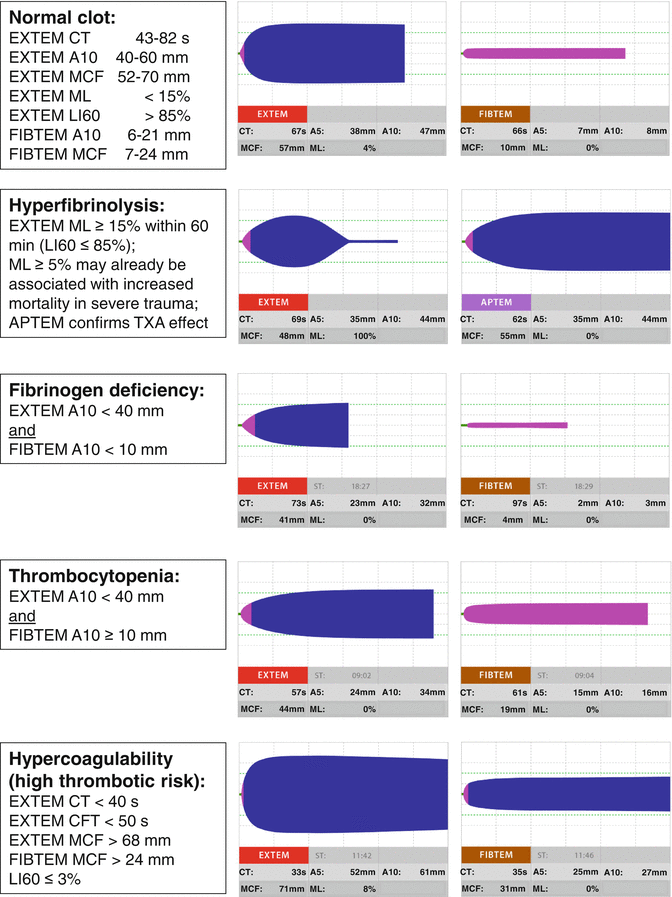 Rotational Thromboelastometry (ROTEM®) | SpringerLink