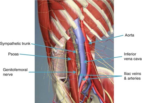 Psoas Muscle Management | SpringerLink