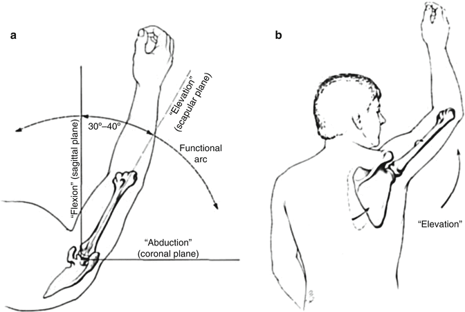 Rehabilitation of Shoulder Arthroplasty | SpringerLink