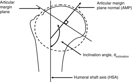 Humeral Head Replacement: Anatomy and Biomechanics | SpringerLink