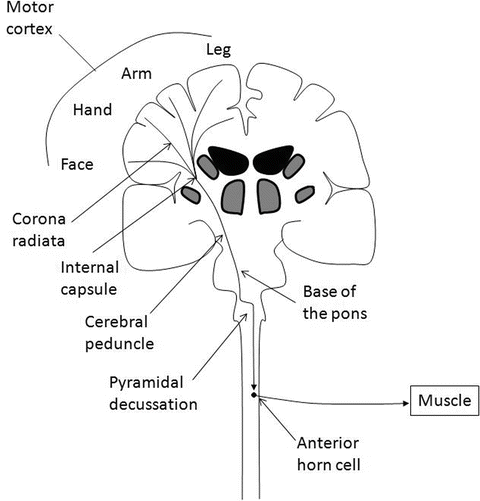 Focal Limb Weakness | SpringerLink