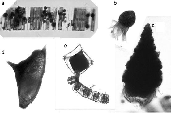Phagotrophic Protists: Central Roles in Microbial Food Webs | SpringerLink