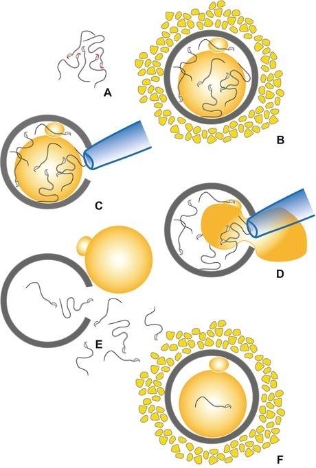 The Acrosome Reaction: A Historical Perspective | SpringerLink