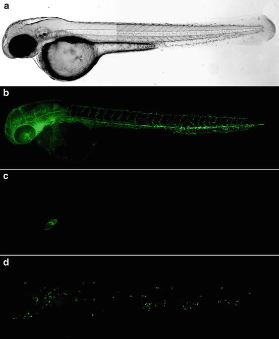 The Zebrafish Xenograft Platform: Evolution of a Novel Cancer Model and ...