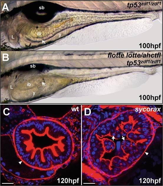 Focusing the Spotlight on the Zebrafish Intestine to Illuminate ...