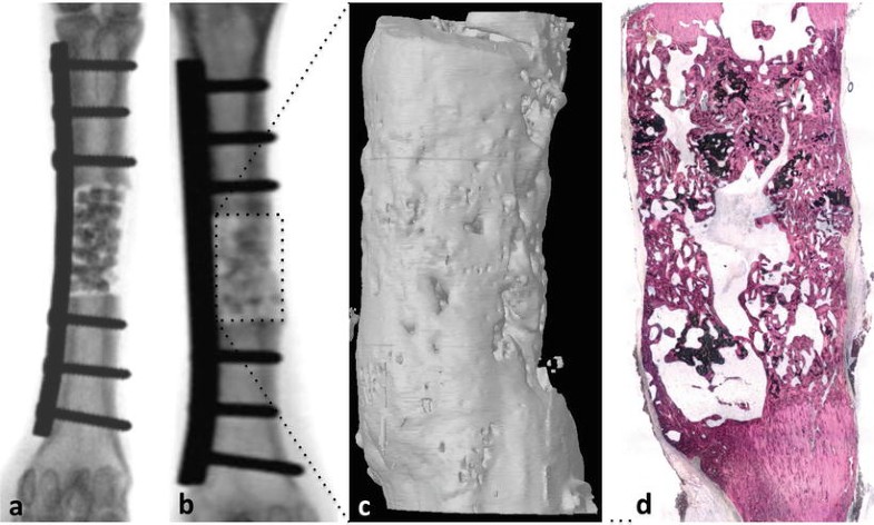 Coral Scaffolds in Bone Tissue Engineering and Bone Regeneration ...