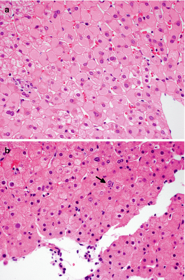 Portal Inflammation | SpringerLink