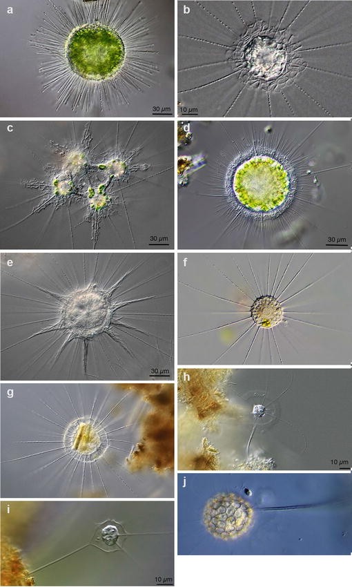 Centrohelida and Other Heliozoan-Like Protists | SpringerLink