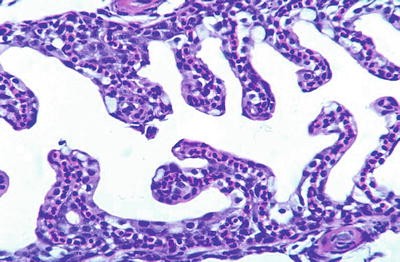 Flavobacteria and Cytophagas | SpringerLink