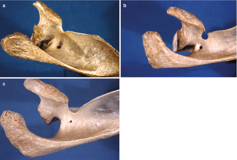 Subacromial Space and Rotator Cuff Anatomy | SpringerLink
