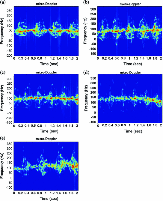 Human Motion Analysis and Classification Using Radar Micro-Doppler Signatures | SpringerLink