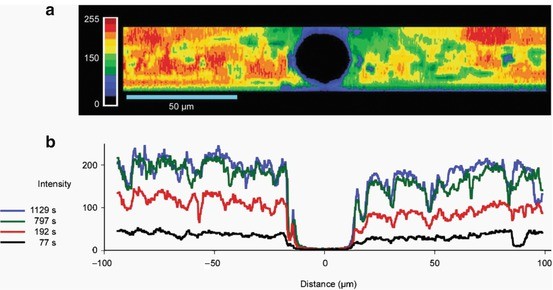 The Revised Starling Principle and Its Relevance to Perioperative Fluid ...