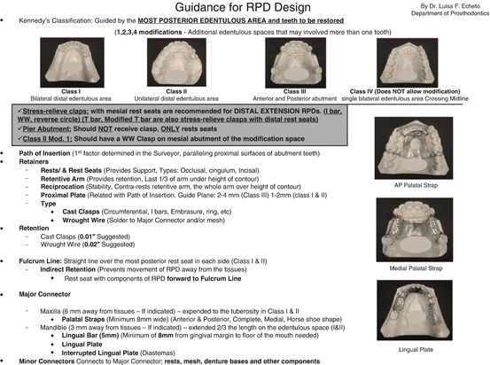 Removable Partial Dentures (RPD) Treatment: A Clinical Guide | SpringerLink