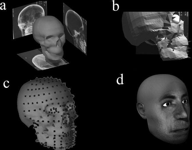 Forensic Facial Reconstruction and Its Contribution to Identification ...