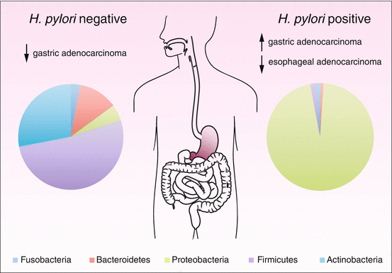 Helicobacter pylori, Cancer, and the Gastric Microbiota | SpringerLink