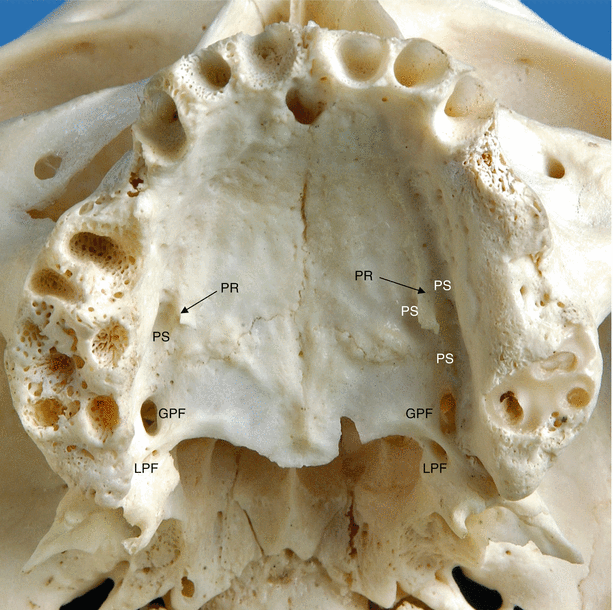 Hard and Soft Palate | SpringerLink