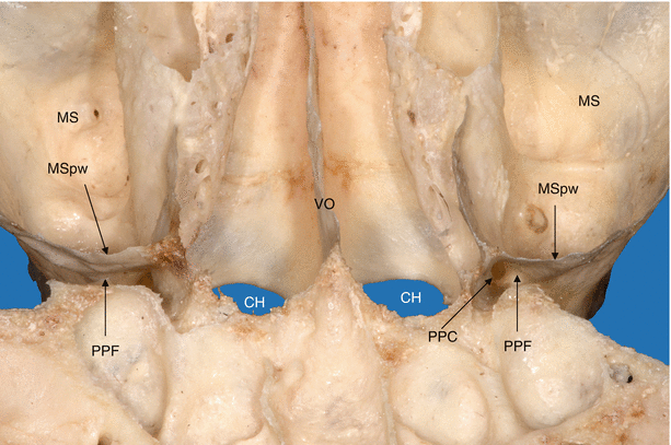 Pterygopalatine Fossa | SpringerLink