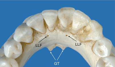 Lingual Foramina and Canals | SpringerLink