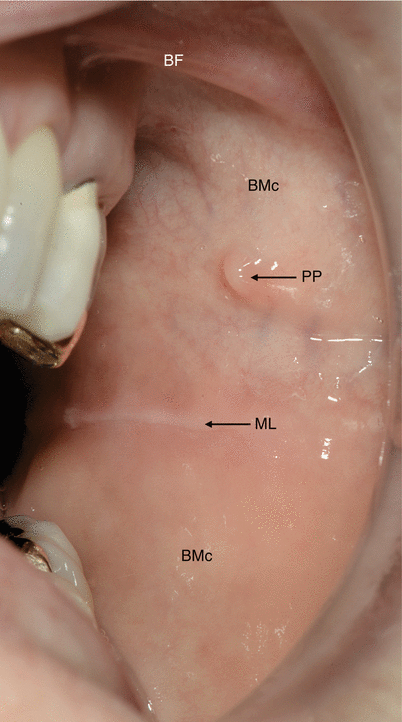 Vestibule and Cheeks | SpringerLink