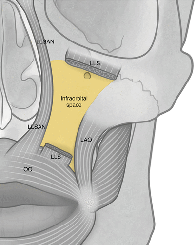 Infraorbital Region | SpringerLink