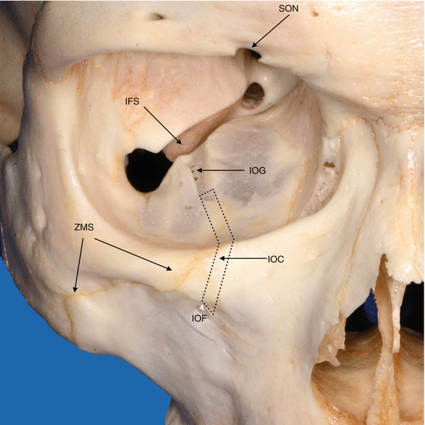Infraorbital Region | SpringerLink