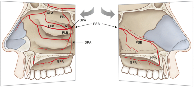 Maxillary Sinus | SpringerLink