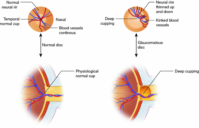 The Eyeball: Some Basic Concepts | SpringerLink