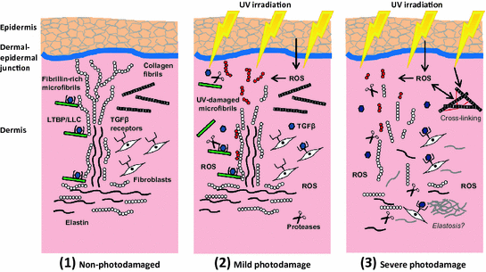 The Skin Extracellular Matrix as a Target of Environmental Exposure ...
