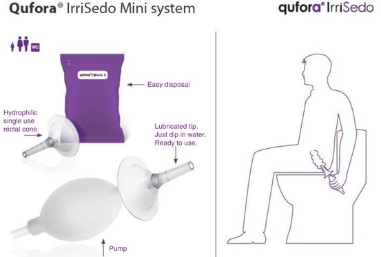 Rectal Irrigation | SpringerLink