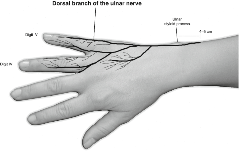 Wrist – Dorsal Hand | SpringerLink