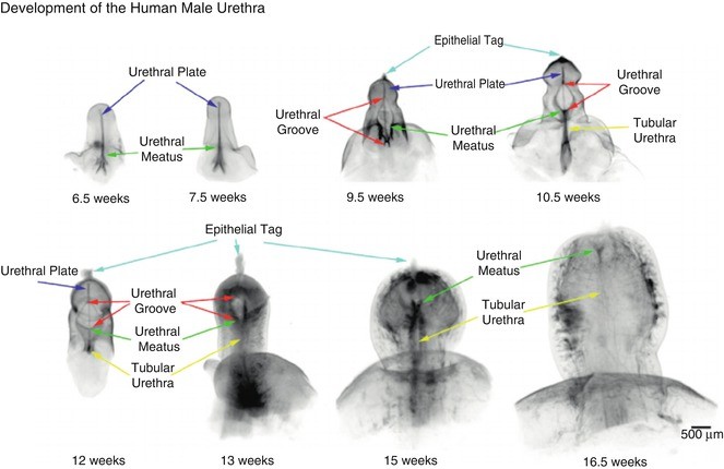 Embryology of the Penis | SpringerLink