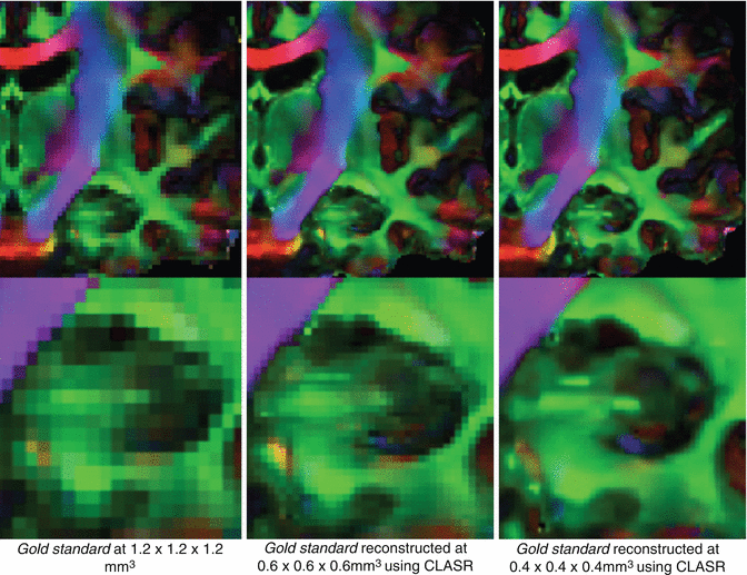 MRI Preprocessing | SpringerLink