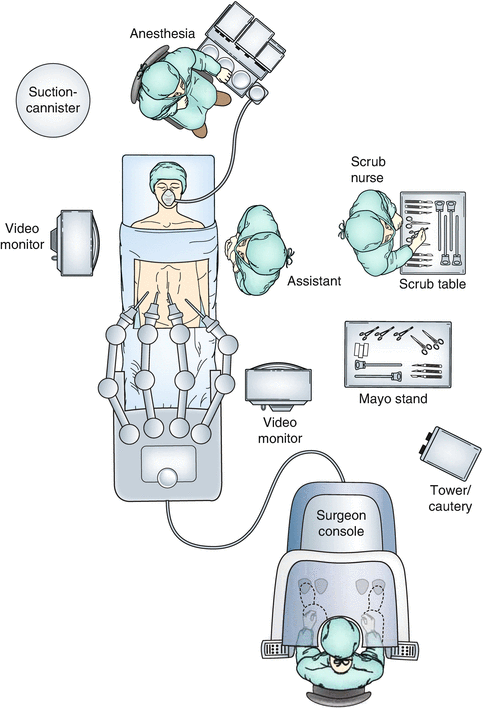 Robotic Simple Prostatectomy | SpringerLink