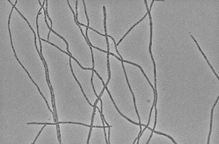 The Chlorobiaceae, Chloroflexaceae, and Heliobacteriaceae | SpringerLink