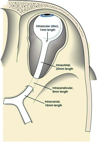 Optic Nerve, Visual Pathways, Oculomotor System, and Consequences of ...