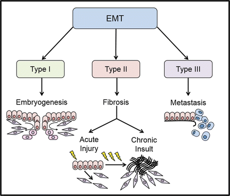 Epithelial to Mesenchymal Transition (EMT) and Endothelial to ...