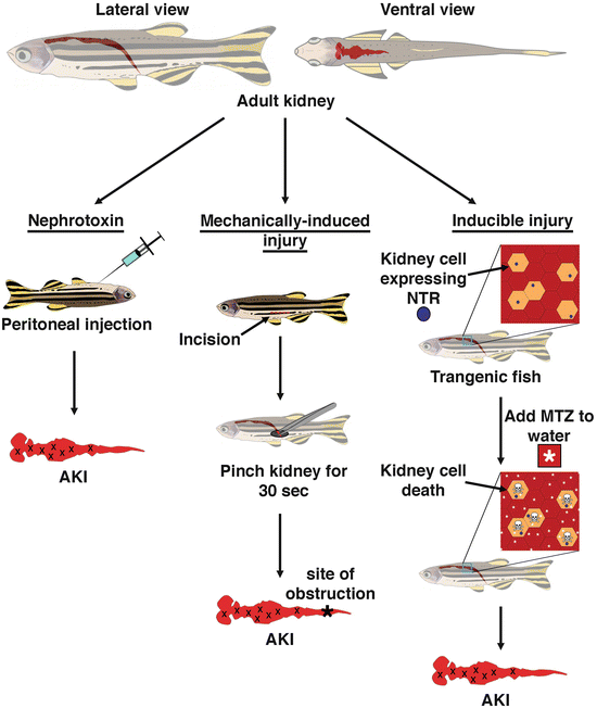 Zebrafish as a Model of Kidney Disease | SpringerLink