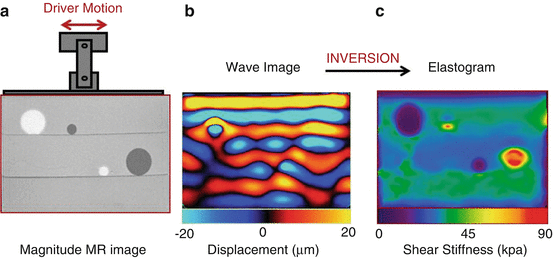 Cardiac Magnetic Resonance Elastography | SpringerLink