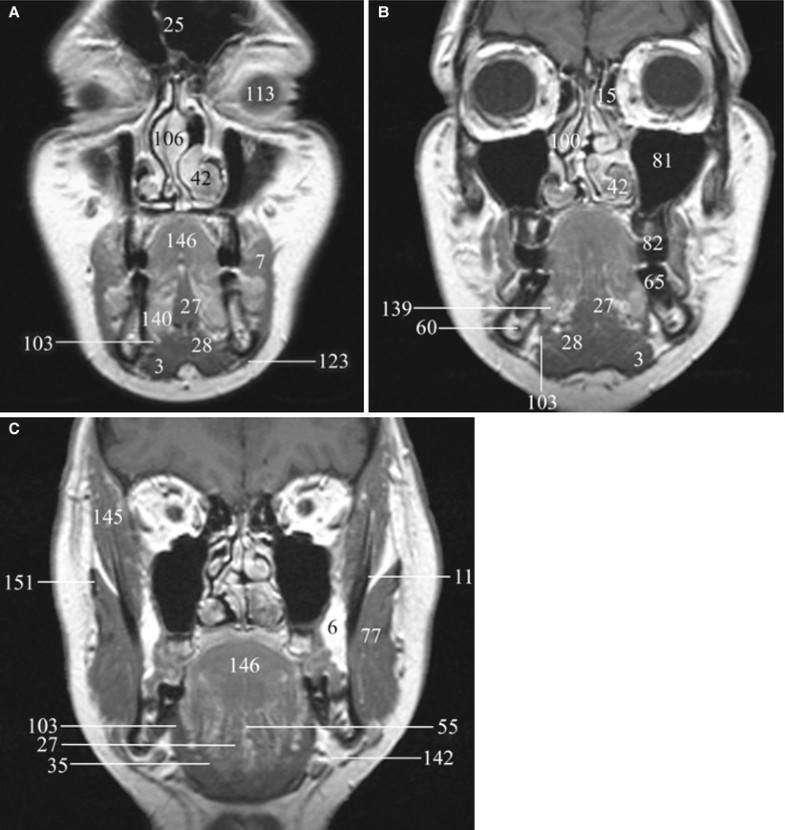 Maxillofacial Imaging Anatomy | SpringerLink
