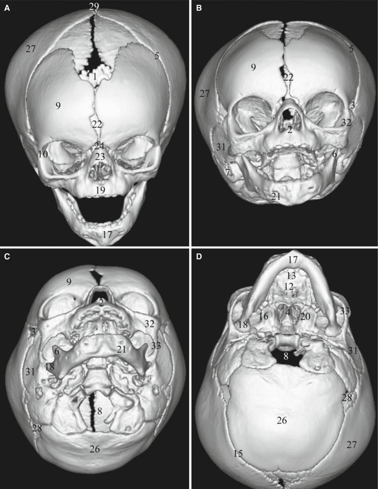 Maxillofacial Imaging Anatomy | SpringerLink