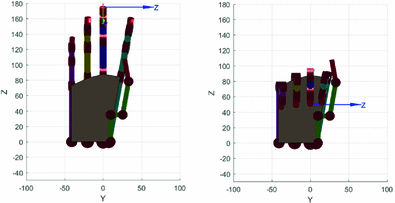 Design of a 3D-Printable Powered Prosthetic Hand for Transmetacarpal ...