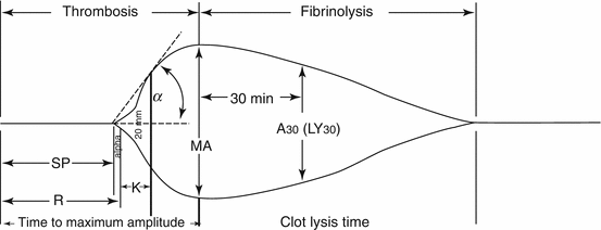 Thromboelastogram I | SpringerLink