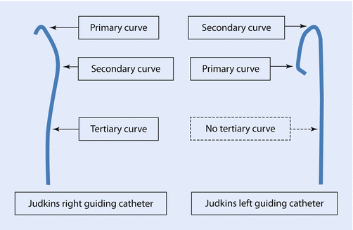 Guiding Catheters | SpringerLink