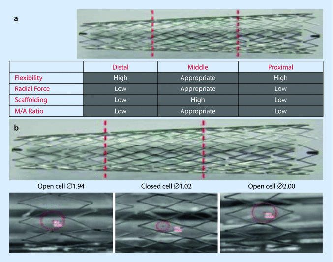 Recent Advances in Carotid Artery Stenting | SpringerLink