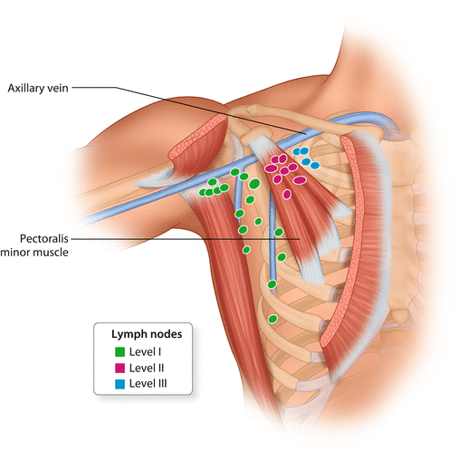 Axillary Node Clearance Springerlink