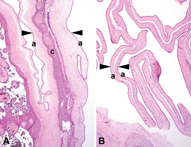 Placenta | SpringerLink