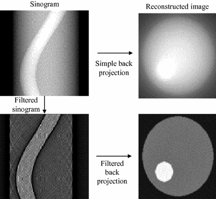 Principles of X-ray Computed Tomography | SpringerLink