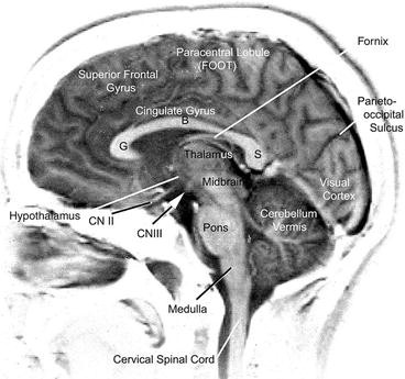 Diencephalon | SpringerLink