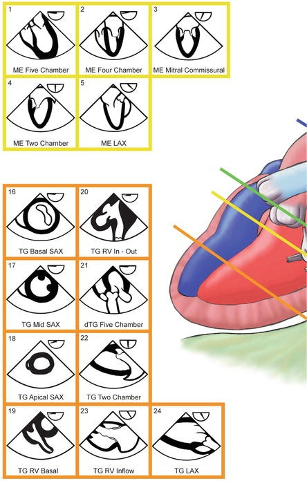 TEE Views | SpringerLink
