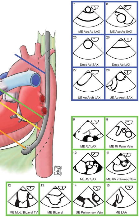 TEE Views | SpringerLink